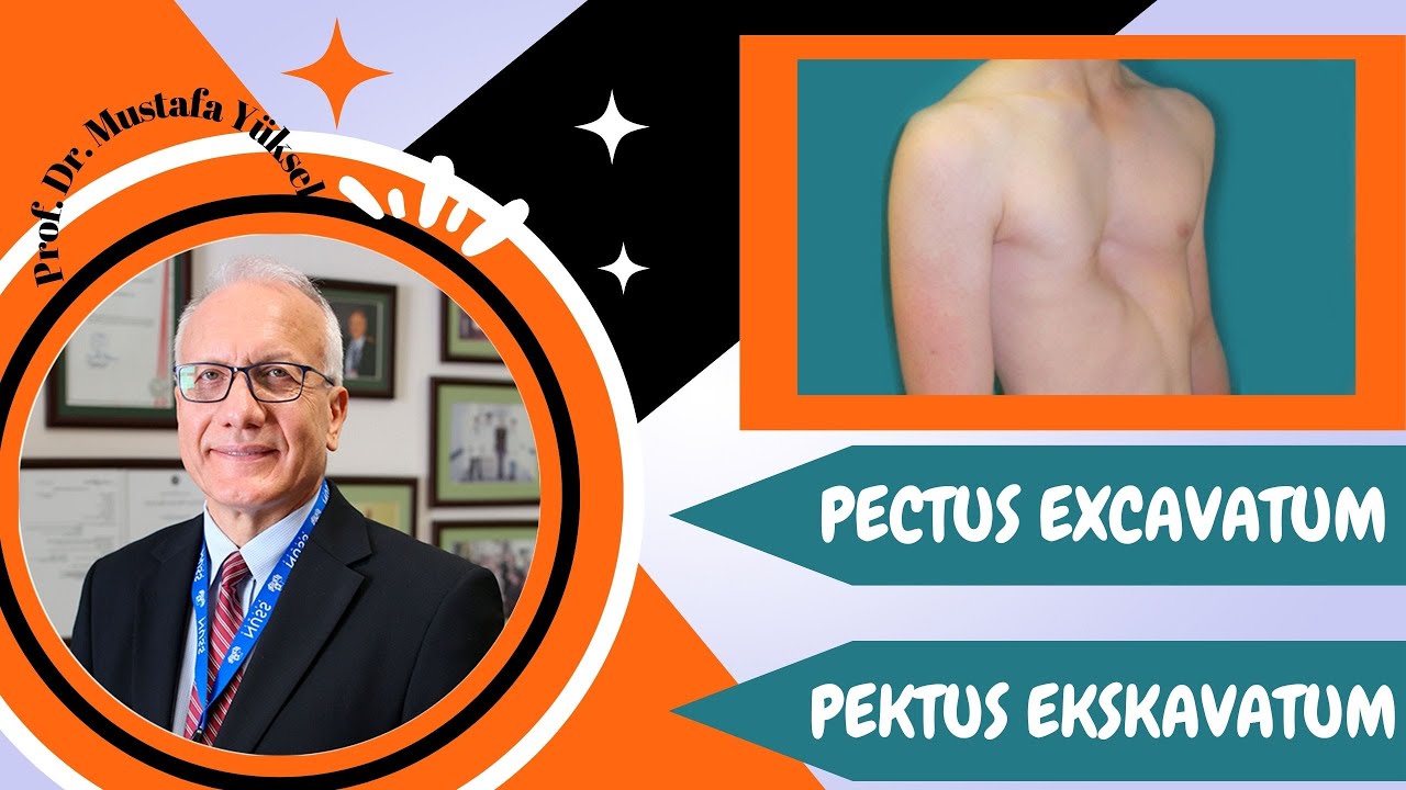 Pektus Ekskavatum Nedir? - YouTube