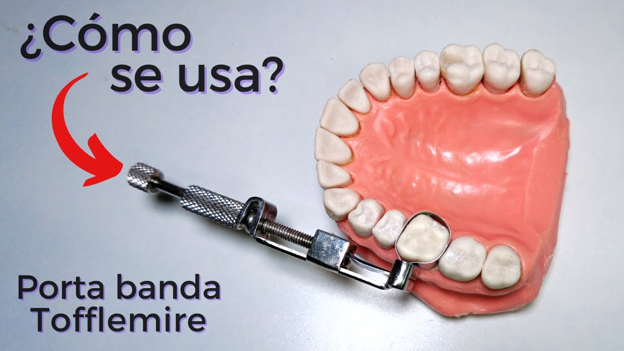 Porta banda matriz Tofflemire - YouTube