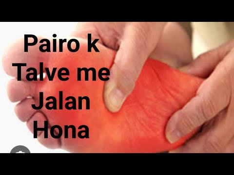 || Pairo 🦶 k Talve me Jalan Hona And How to Reduce It || Burning ...