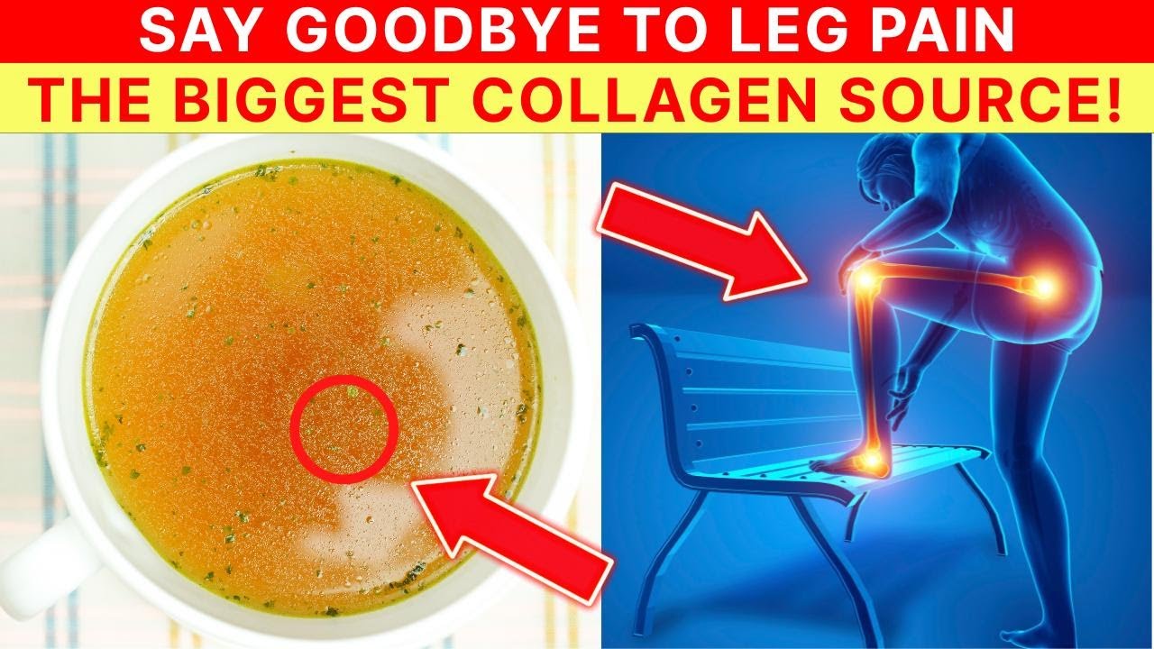 GOODBYE Swelling! Top 5 Collagen Sources for Strong LEGS & Joints You ...