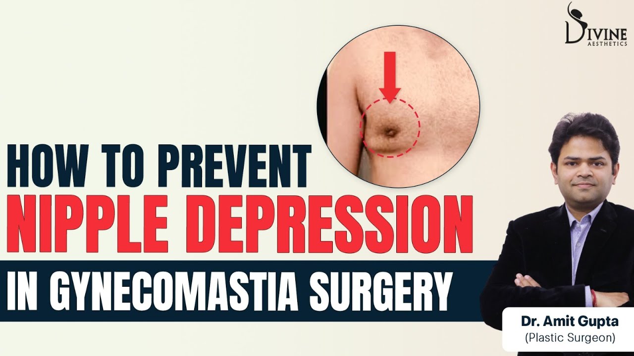 How to Prevent Nipple Depression in Gynecomastia Surgery? - YouTube