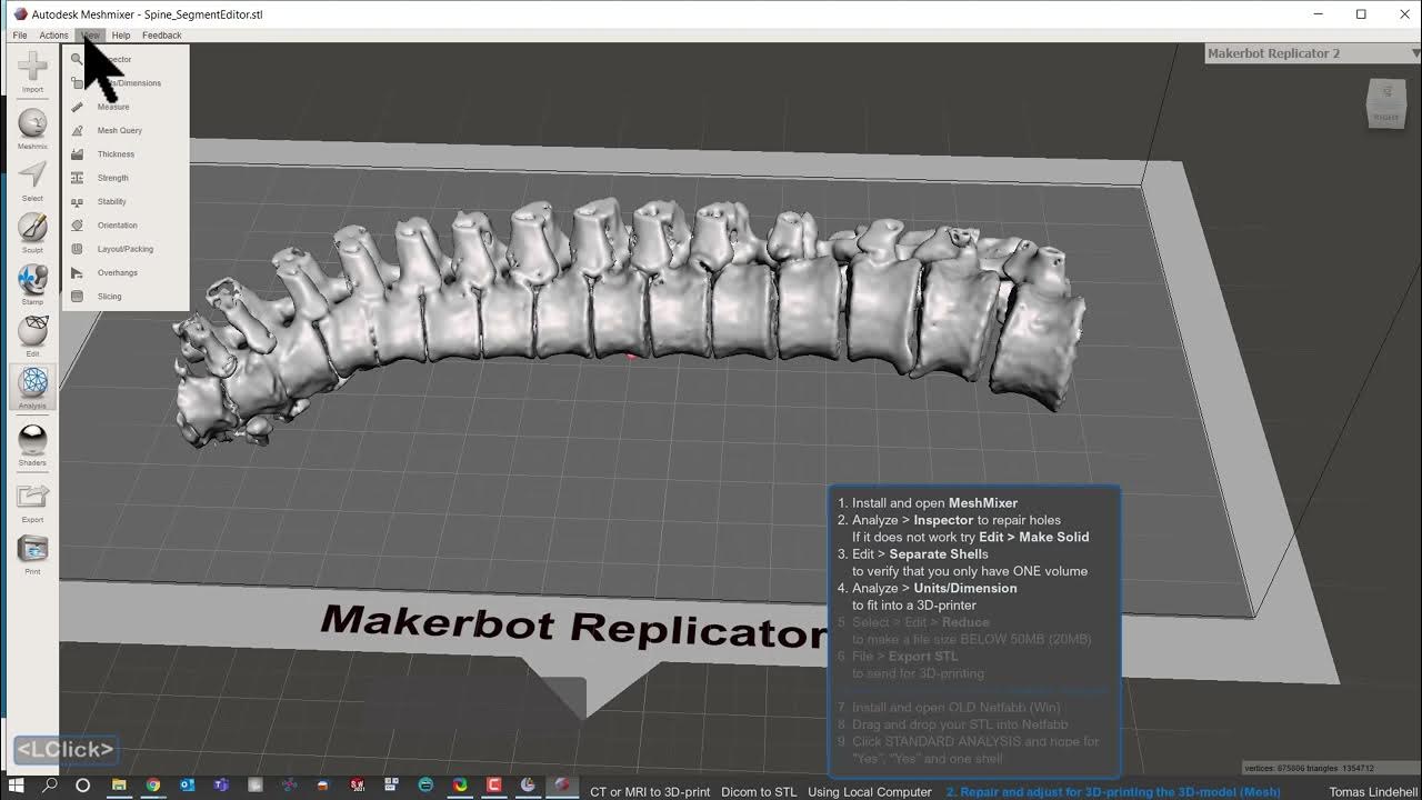 CT or MRI to 3D print DICOM to STL with Local computer Part 2 of 2 ...