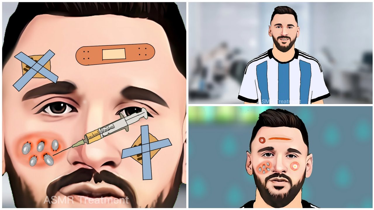 ASMR Treatment Animation Messi ASMR Treatment Relex Video animation ...