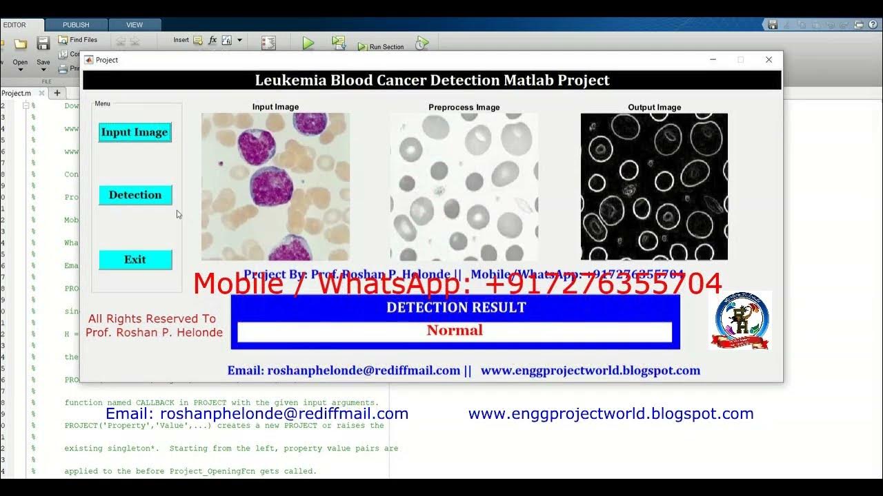 Leukemia Blood Cancer Detection Using Image Processing With Source Code LeukemiaDetect ...