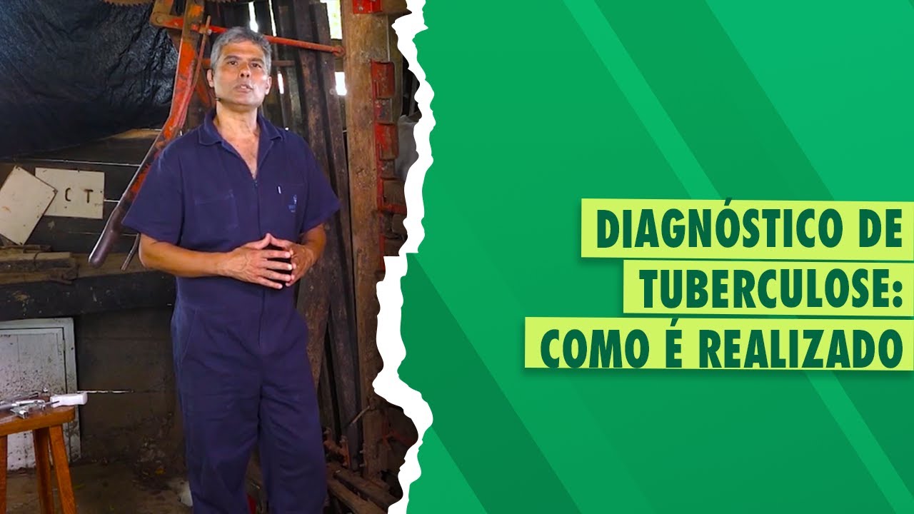 Teste da Tuberculina Intradérmica - YouTube