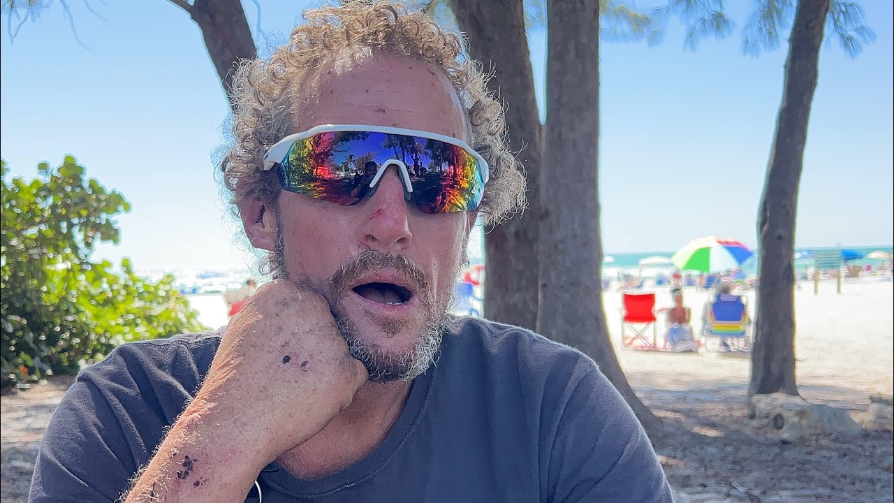 Homeless On The Beach - Florida Man With Addictive Personality “There ...