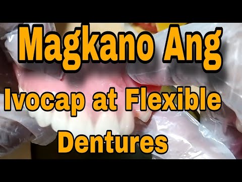 Magkano Ang Pustiso Ivocap Dentures At Flexible Dentures.