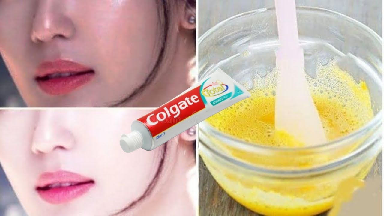 Toothpaste mask for skin whitening! Whitening dark spots! #skincare ...