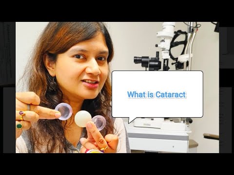 What is Cataract/ Motiyabind/Safed Motiya? - YouTube