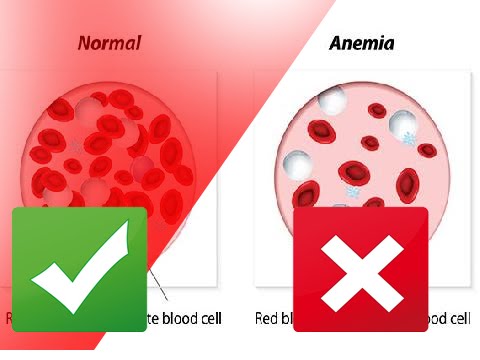 Anemia in Dogs - Causes, Symptoms and treatments - YouTube