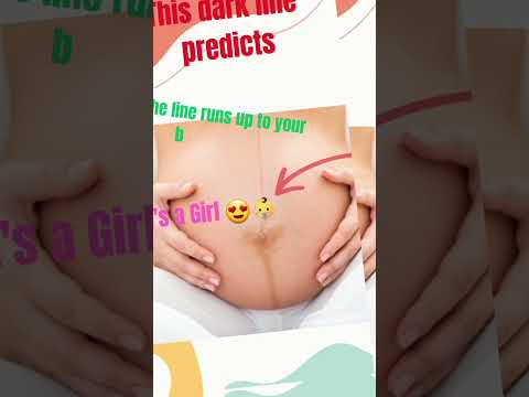 Linea Nigra Predicts Gender?🤫😮 #shorts