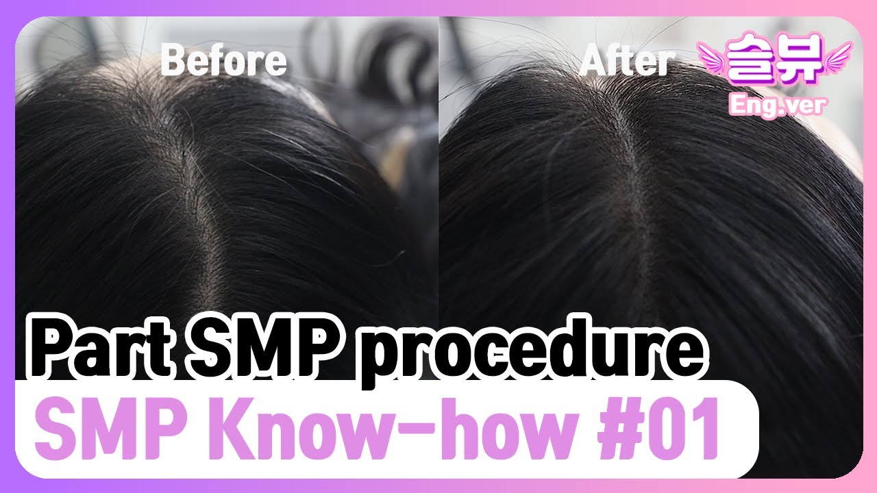 [SMP Education] Let me tell you guys about SMP procedure and know-hows ...
