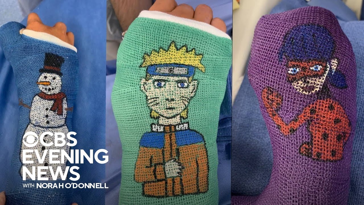 Doctor gives pediatric patients custom cast art - YouTube