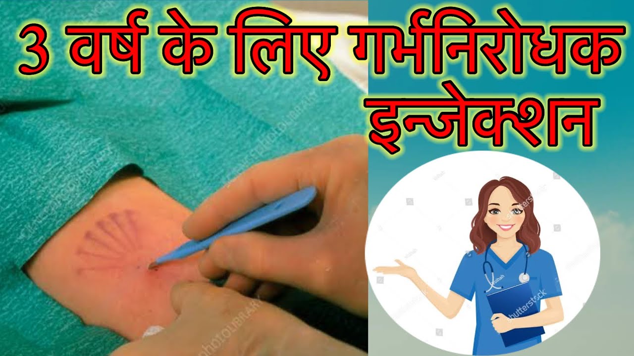 Implant contraception || implant contraceptive procedure || implant ...