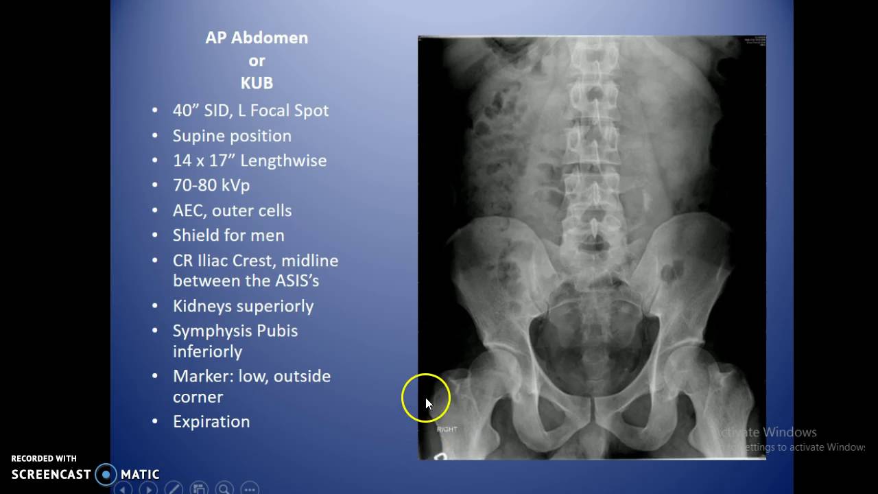 PPT Abdomen X-rays Voice-over - YouTube