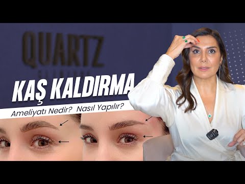Kaş Kaldırma Ameliyatı Nedir? Nasıl Yapılır? | Op. Dr. Leyla ARVAS