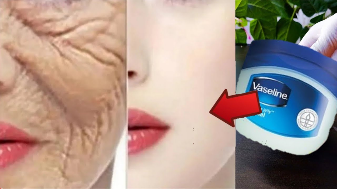 Remove WRINKLES Permanently Overnight, Get Rid of Finelines and WRINKLE ...