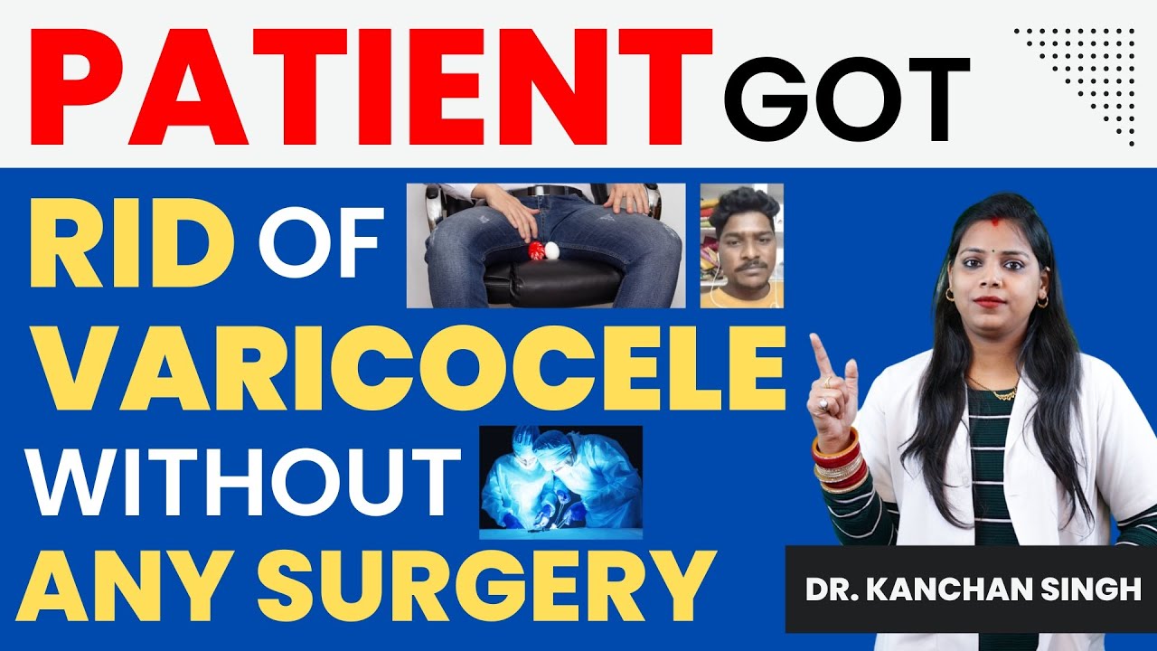 This Process Of Recovery Helps Varicocele Patients To Avoid Surgery