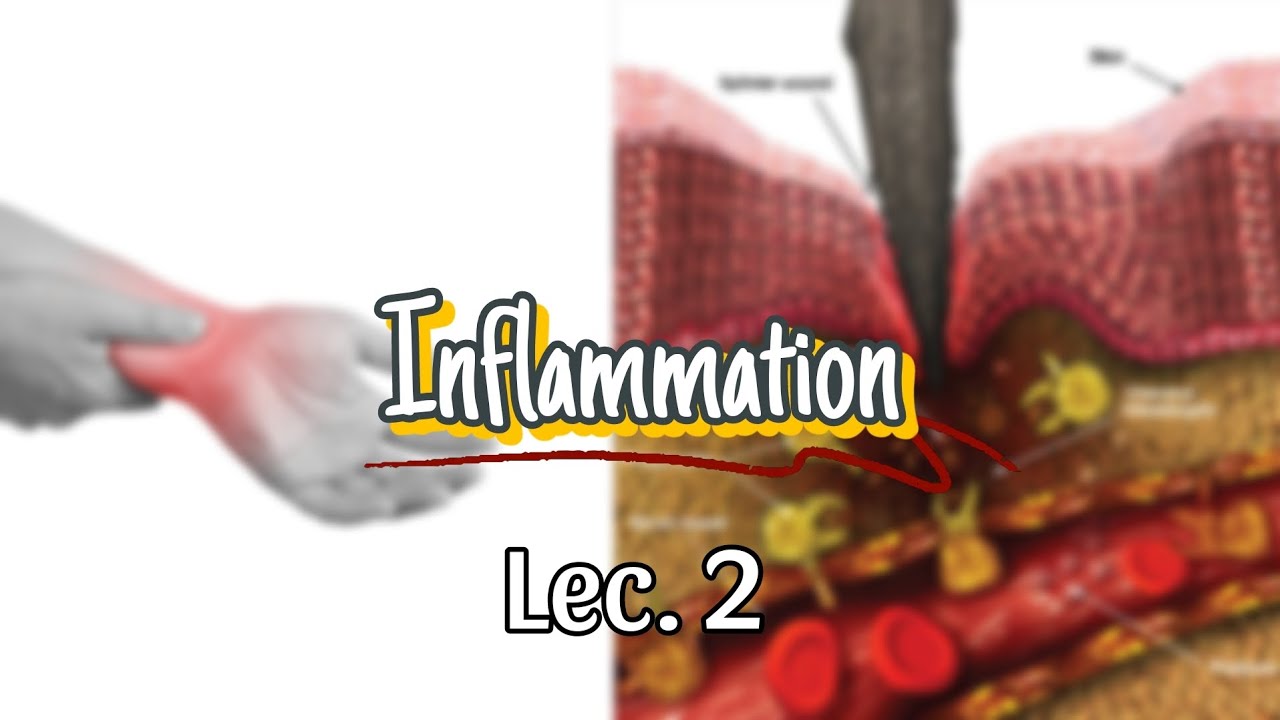 Inflammation-Lecture 2(Types of acute inflammation) - YouTube