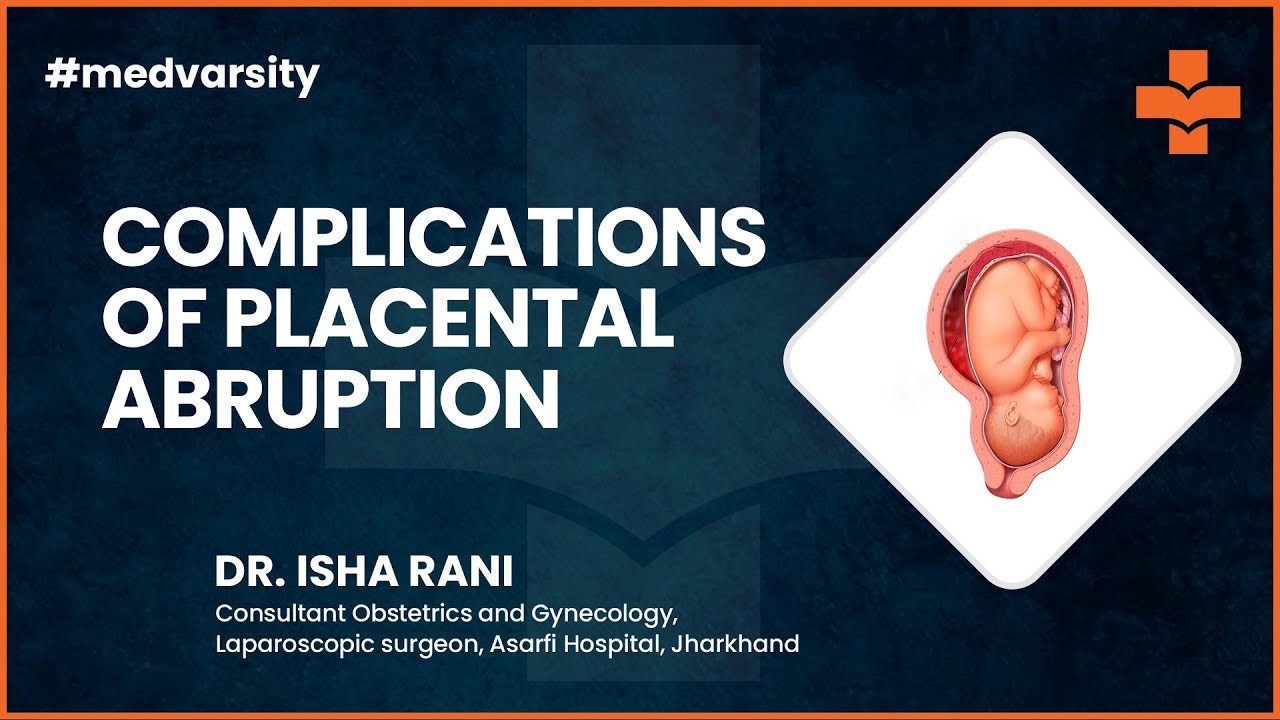 Case Discussion on Complications of Placental Abruption - YouTube