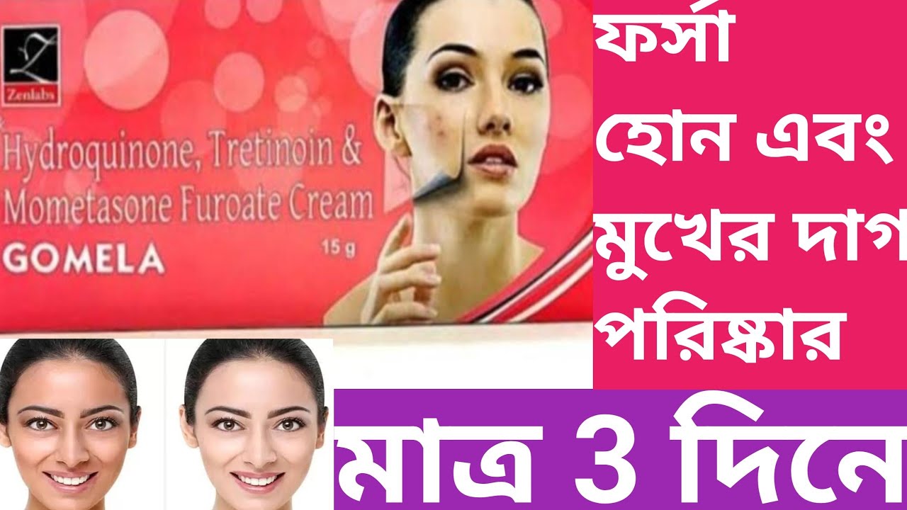 Gomela Cream Use In Bengali | গোমেলা ক্রিম কি ফর্সা হওয়ার জন্য ? - YouTube