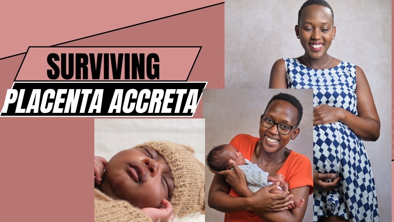 My miraculous pregnancy journey from conception to birth and beyond |Placenta Accreta :-) - YouTube