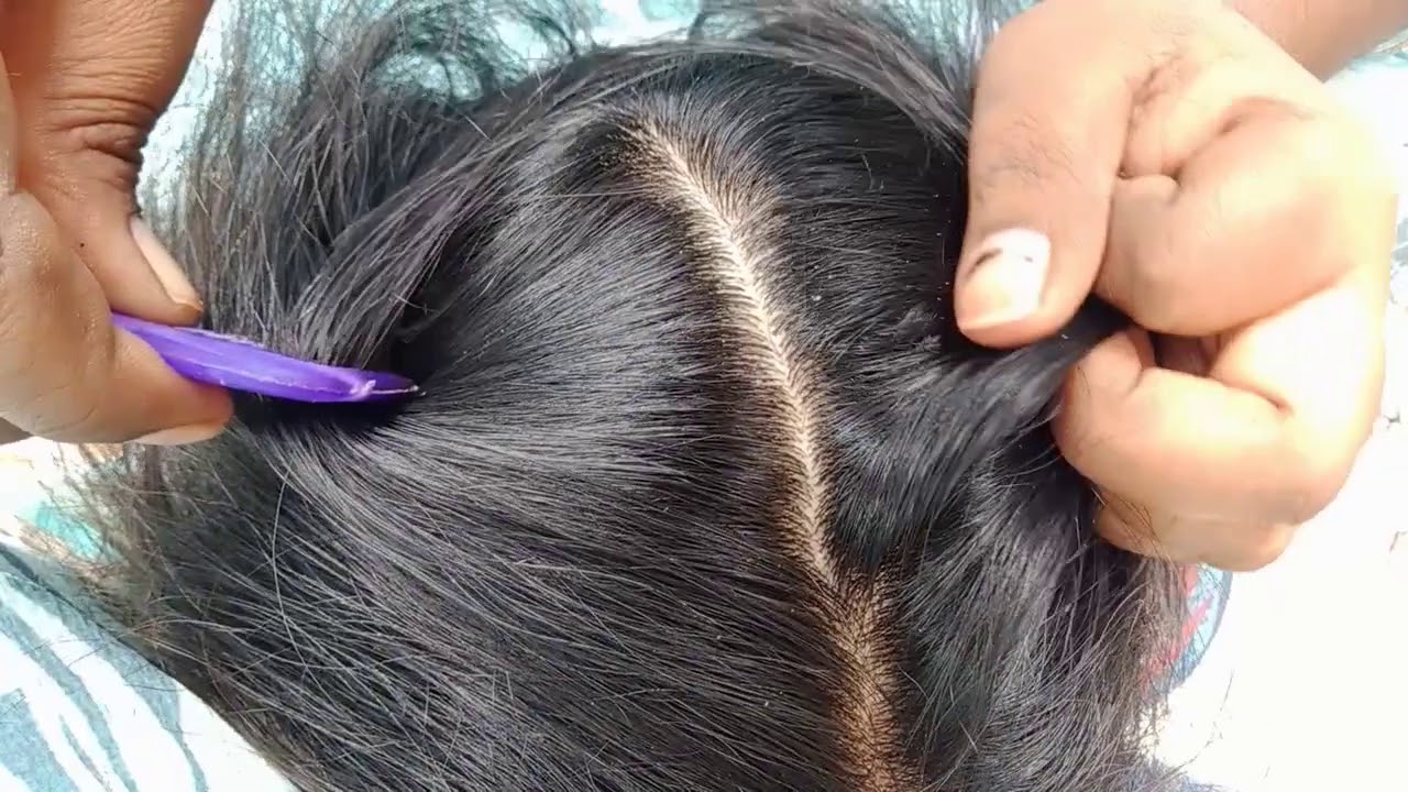 Nitpicking by comb and Hands ll nitpiking by braide ll Licepiking - YouTube