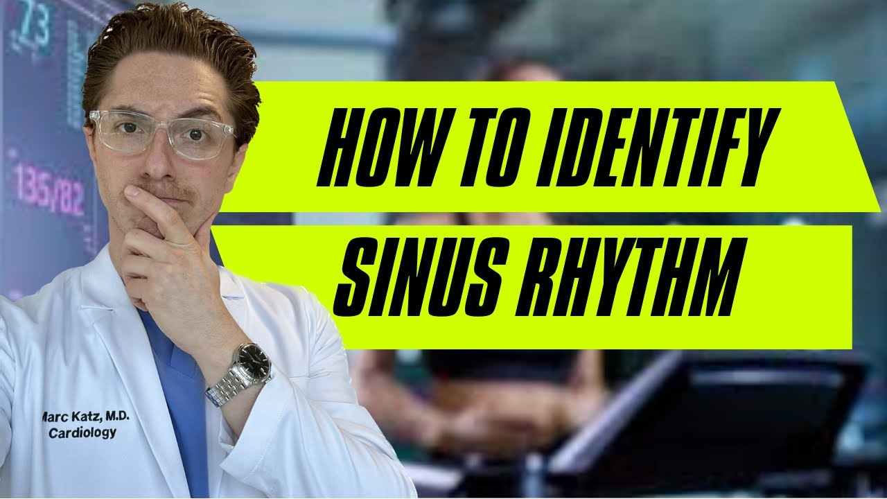How to Identify Sinus Rhythm on ECG - YouTube