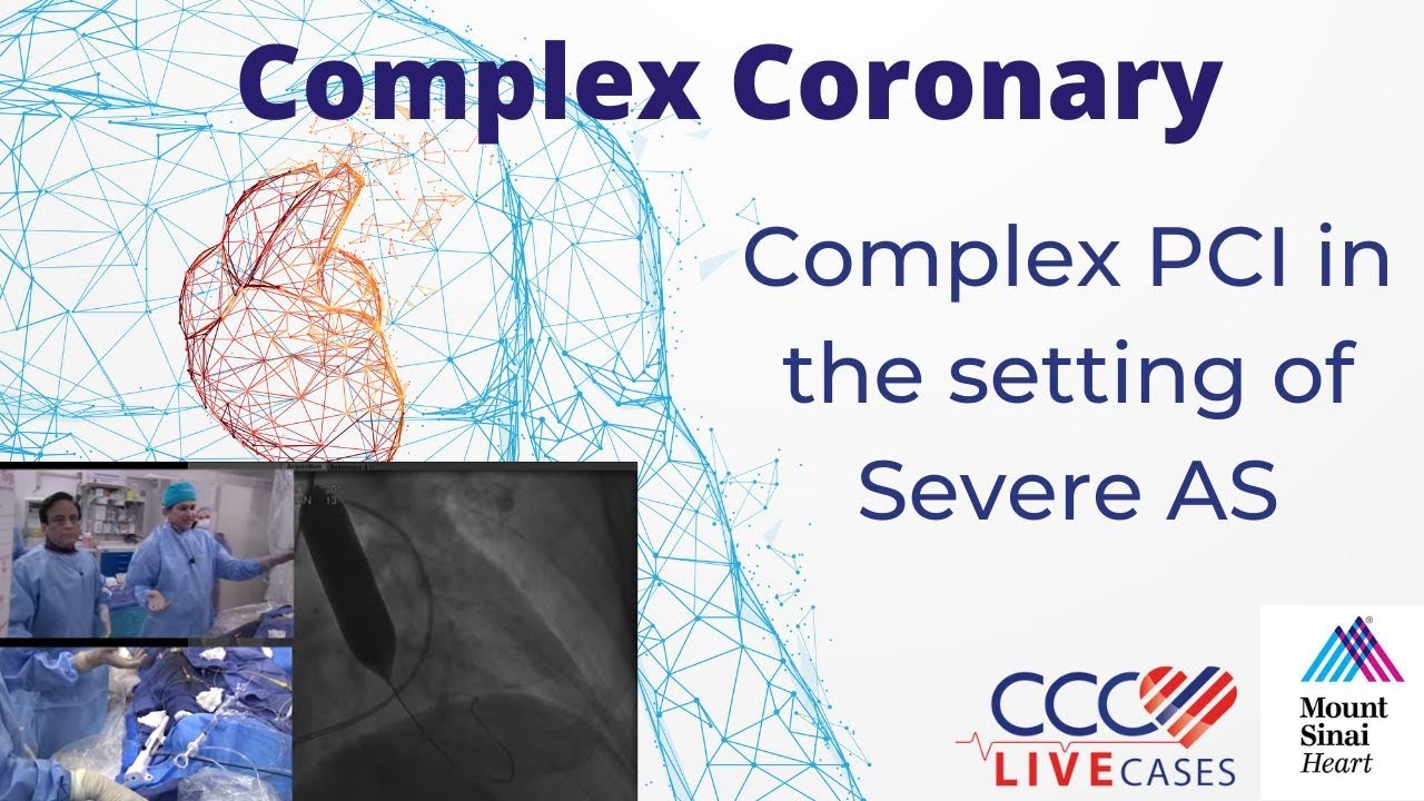 Complex PCI in the setting of Severe AS - April 17, 2018 - YouTube