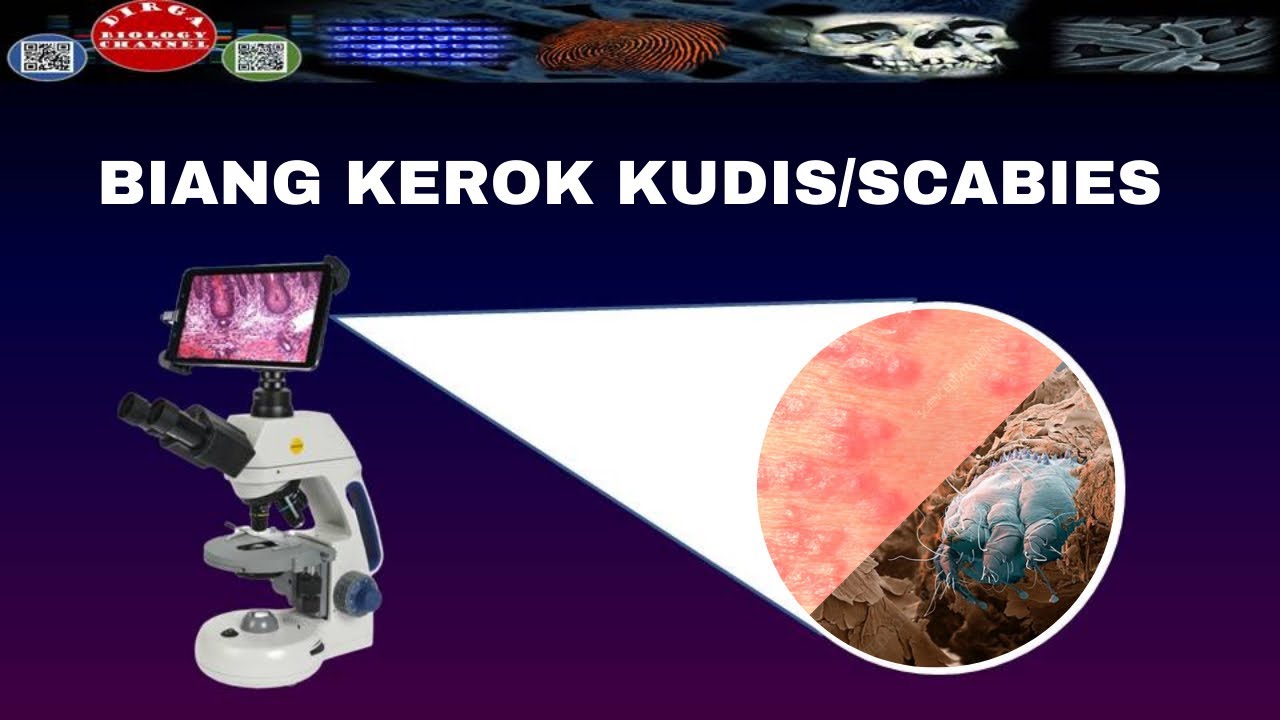 ZOOM MIKROSKOP...TUNGAU PENYEBAB KUDIS/SCABIES/GUDIK - DIRGA BIOLOGY ...