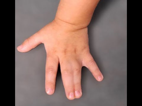 How to give yourself webbed fingers - YouTube