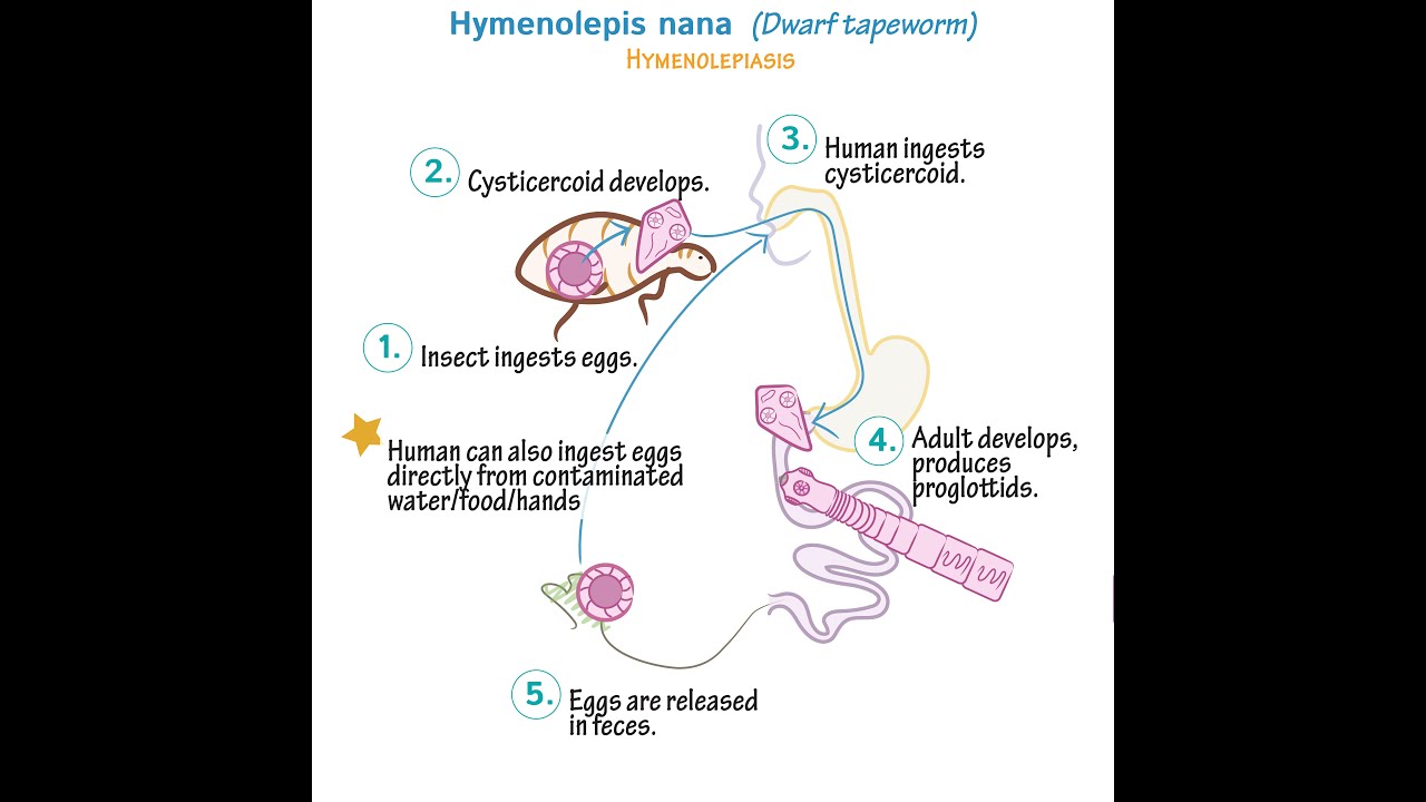 Hymenolepiasis ; Causes, Risks, Symptoms, Diagnosis, Treatment - YouTube