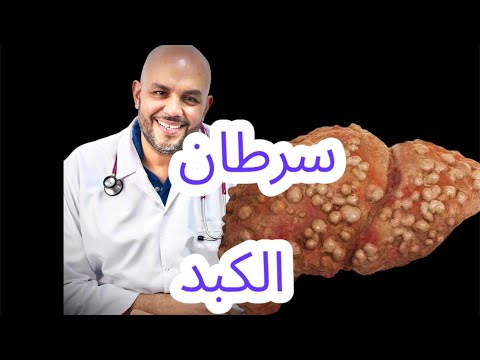 سرطان الكبد / Cancer liver