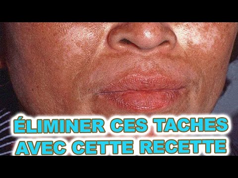 Koltuk altlarınızı 10 dakika içinde ağartın ve cilalayın: uygulayın ve durulayın