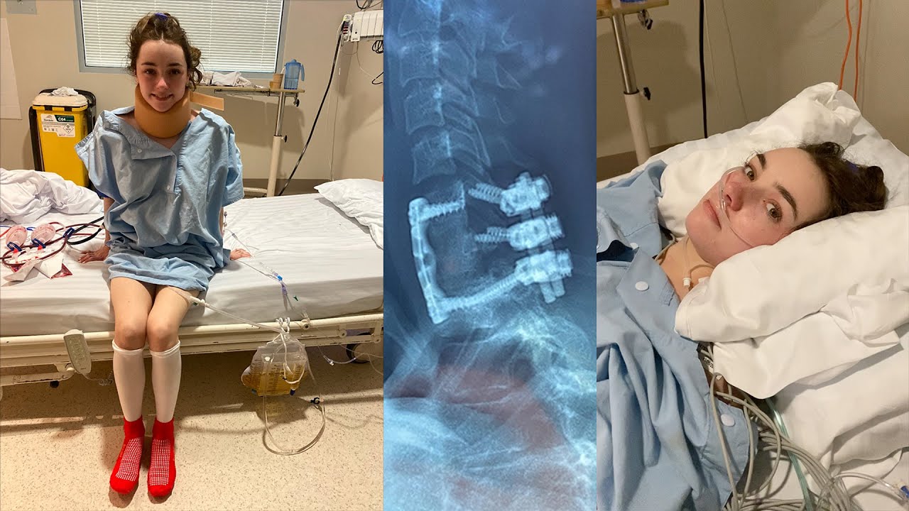 i had NECK SURGERY for the 2nd time! - YouTube