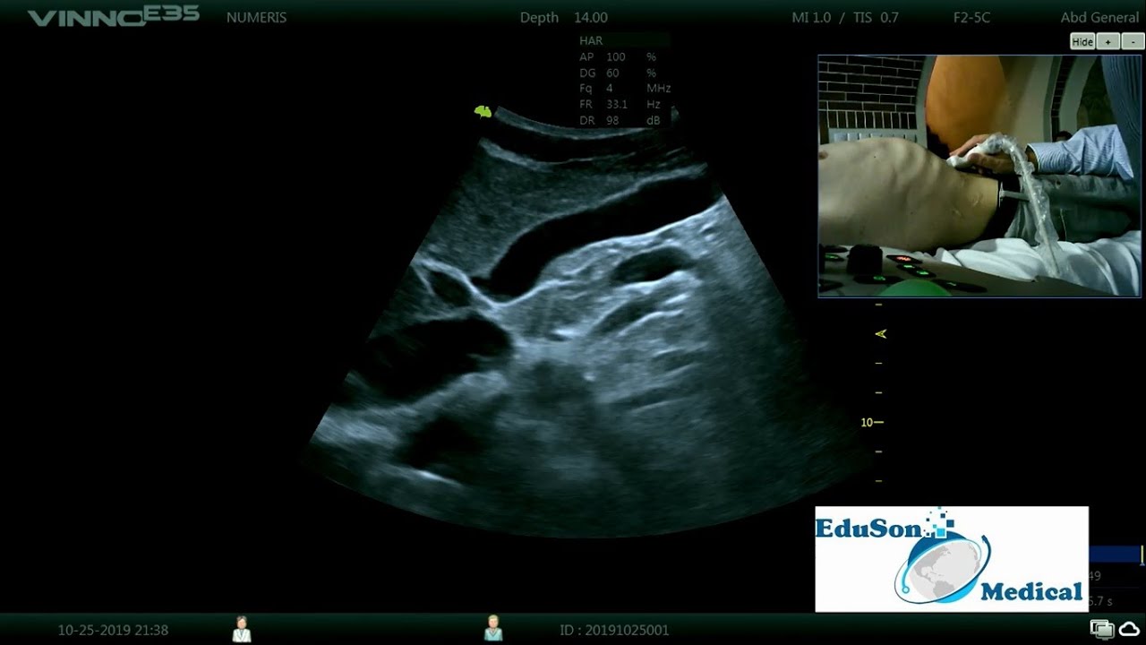 EDUSON - Modulul I, Cursul 3: Tehnică de examinare ecografică și ...