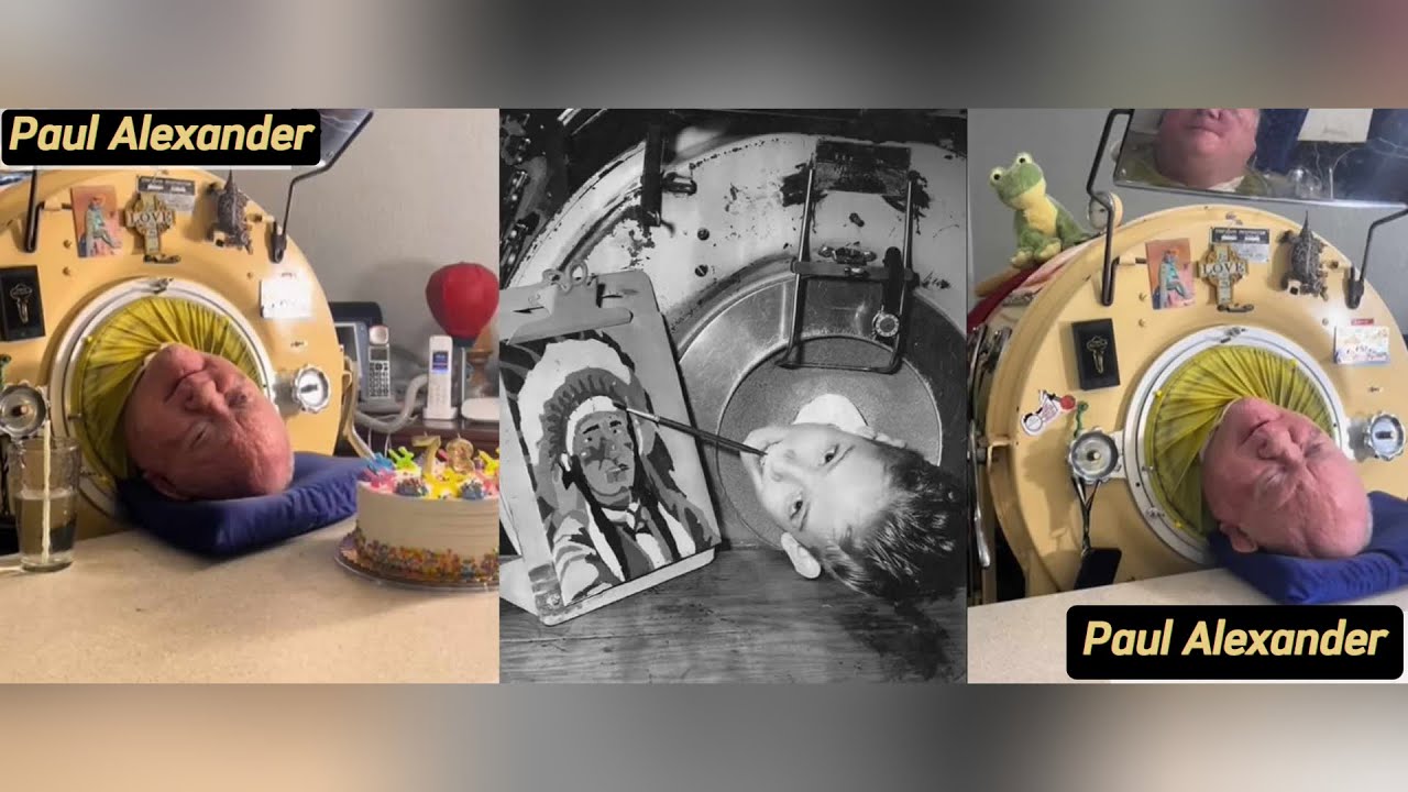 Paul Alexander, vivió +70 años en un ‘pulmón de acero’, una historia ...