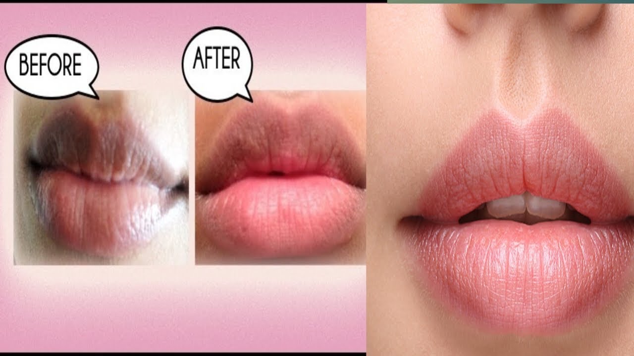 क्या आपके bhi lips black ho g hai ek bhar ye lga or apne lips👄 ko pink ...