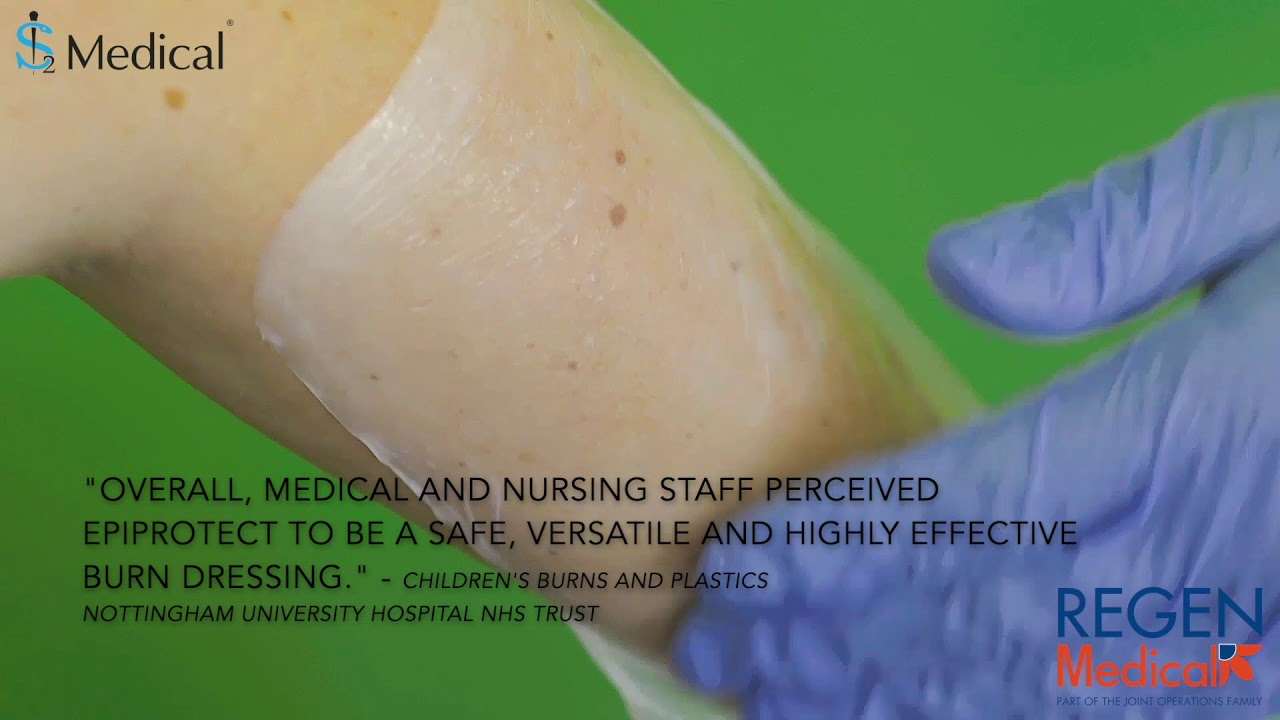 EpiProtect - a close up look - YouTube