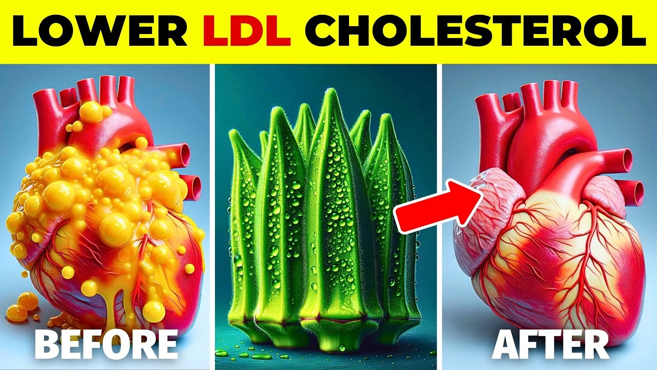 TOP 10 Foods To LOWER Bad (LDL) Cholesterol Naturally - YouTube
