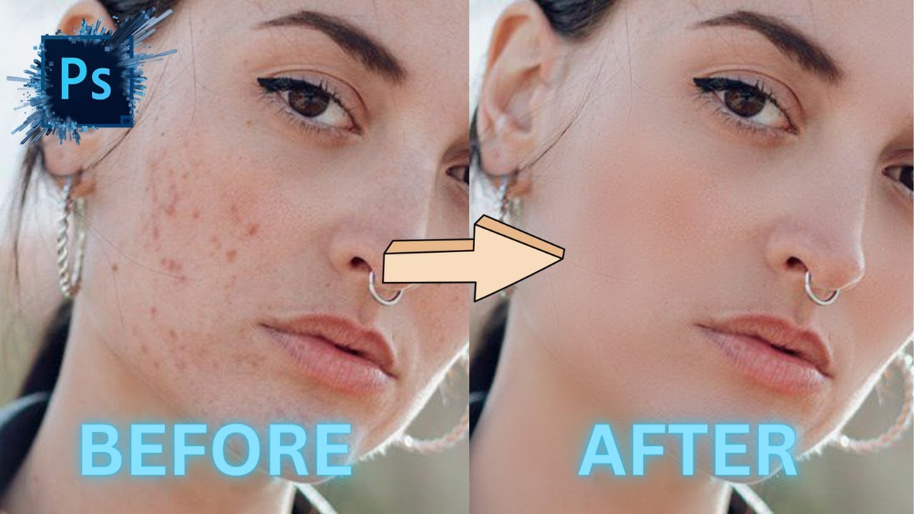 REMOVE PIMPLE PHOTOSHOP TUTORIAL-PHOTOSHOP TUTORIALS - YouTube