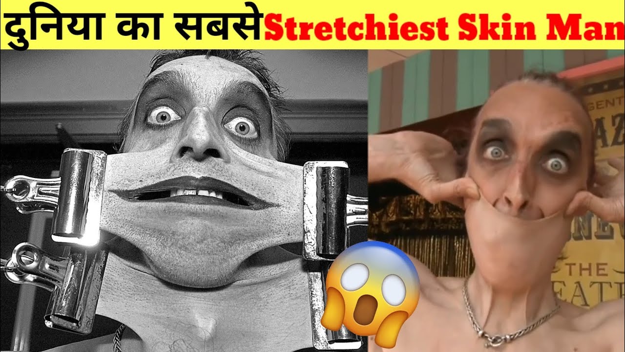 World's | Stretchiest Skin Man |#shorts😱 |factzilla| - YouTube