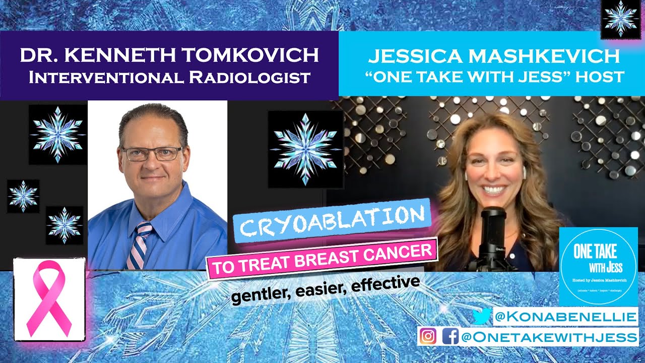 #51 Dr. Ken Tomkovich & Jess talk about cryoablation for breast cancer ...
