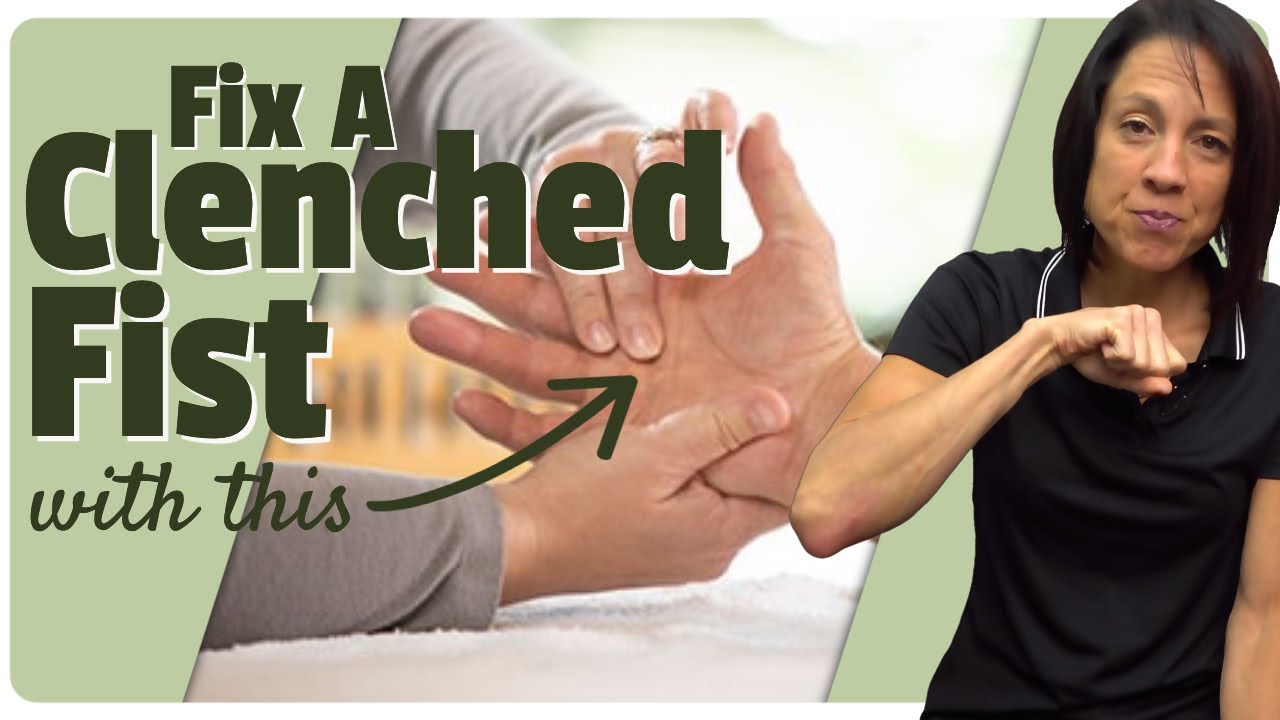 Best Treatment for Post Stroke Spasticity - YouTube