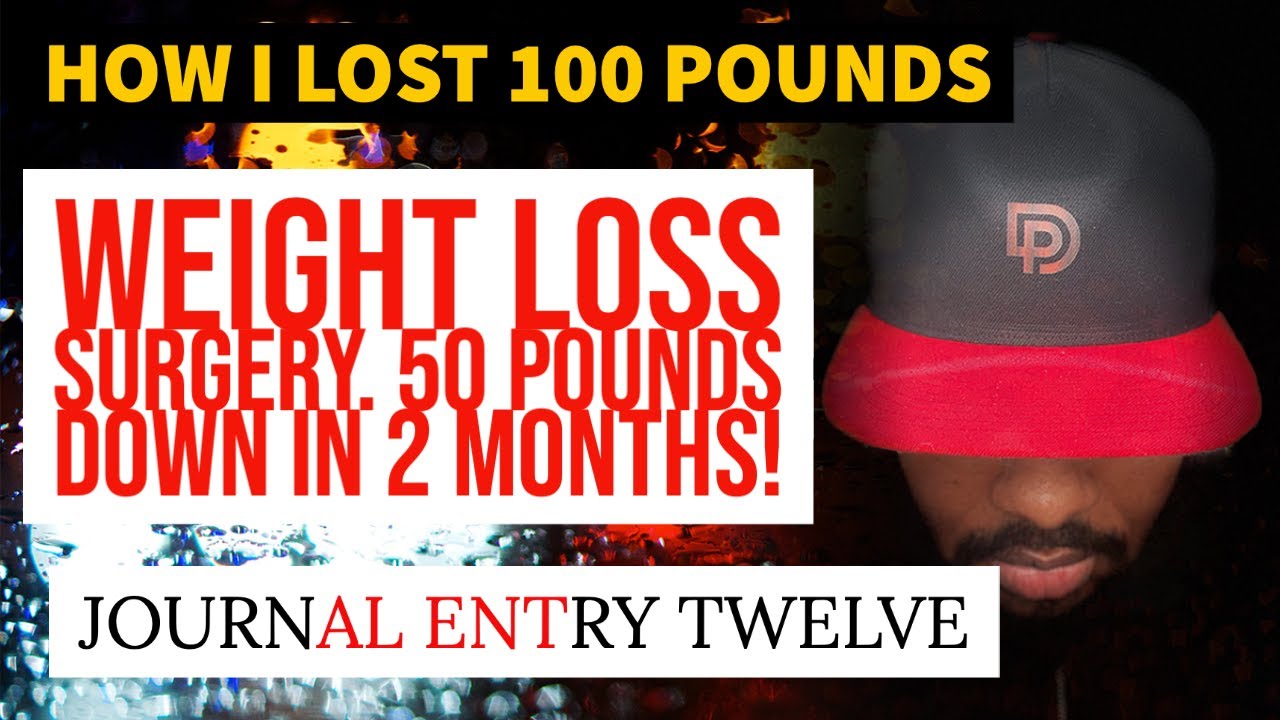 Weight Loss Surgery. 50 POUNDS DOWN IN 2 MONTHS!: How I Lost 100 Pounds ...