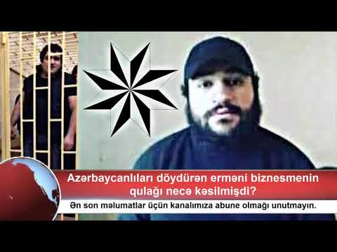 Azərbaycanlıları döydürən erməni biznesmenin qulağı necə kəsilmişdi