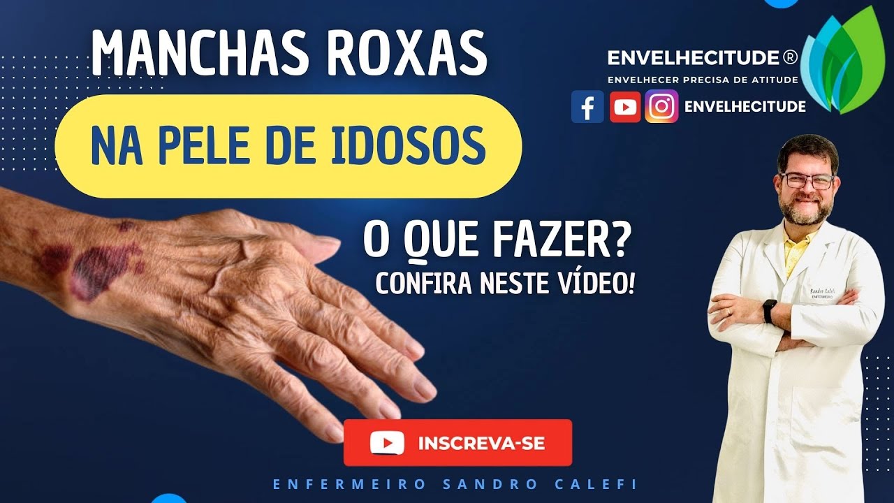 MANCHAS ROXAS NA PELE DO IDOSO: O QUE FAZER? - YouTube