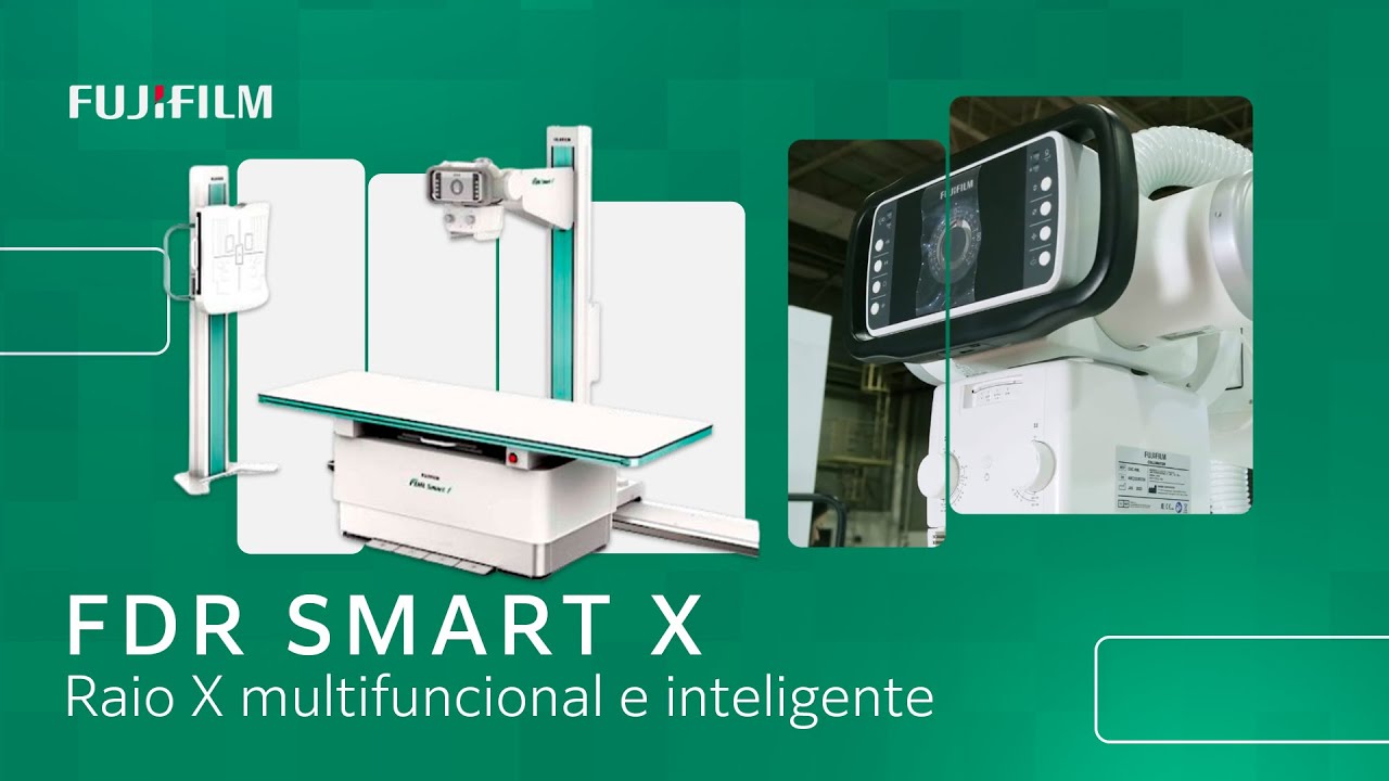 FDR SMART X: O EQUIPAMENTO DE RAIO X DIGITAL E MULTIFUNCIONAL DA ...