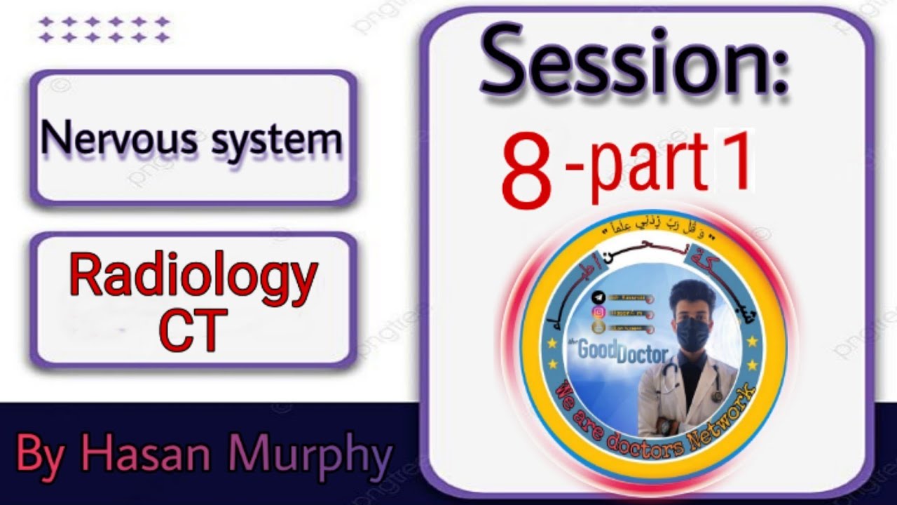 Nervous system|| Session 8-part1|| Radiology CT scan || by Hasan Murphy ...