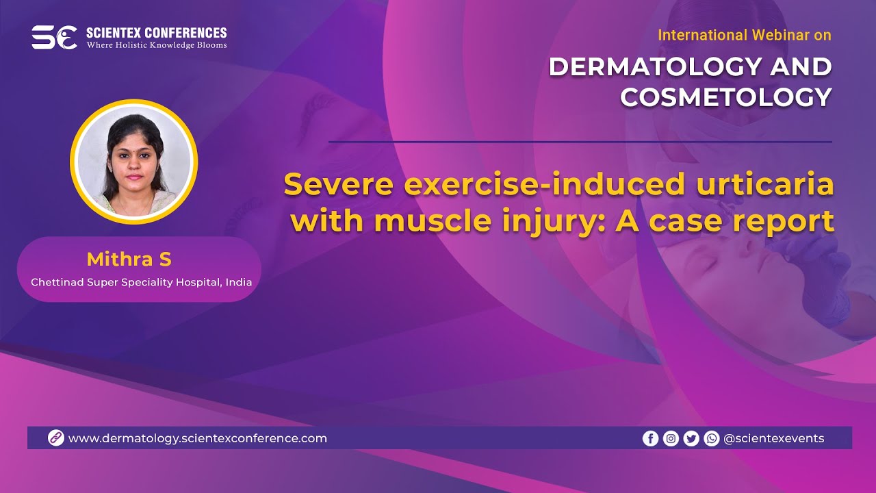 Severe exercise-induced urticaria with muscle injury: A case report ...